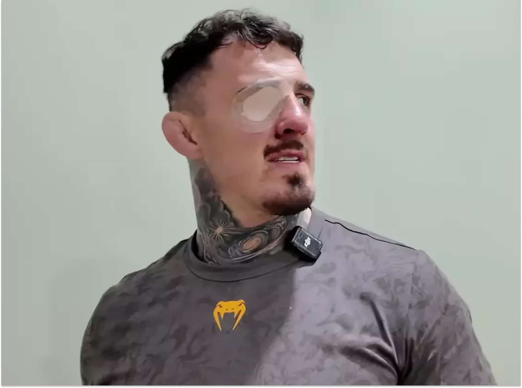 Après avoir reçu un doigt dans l’œil en affrontant Ciryl Gane, Tom ...